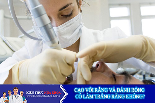 Cạo Vôi Răng Và Đánh Bóng Có Làm Trắng Răng Không?